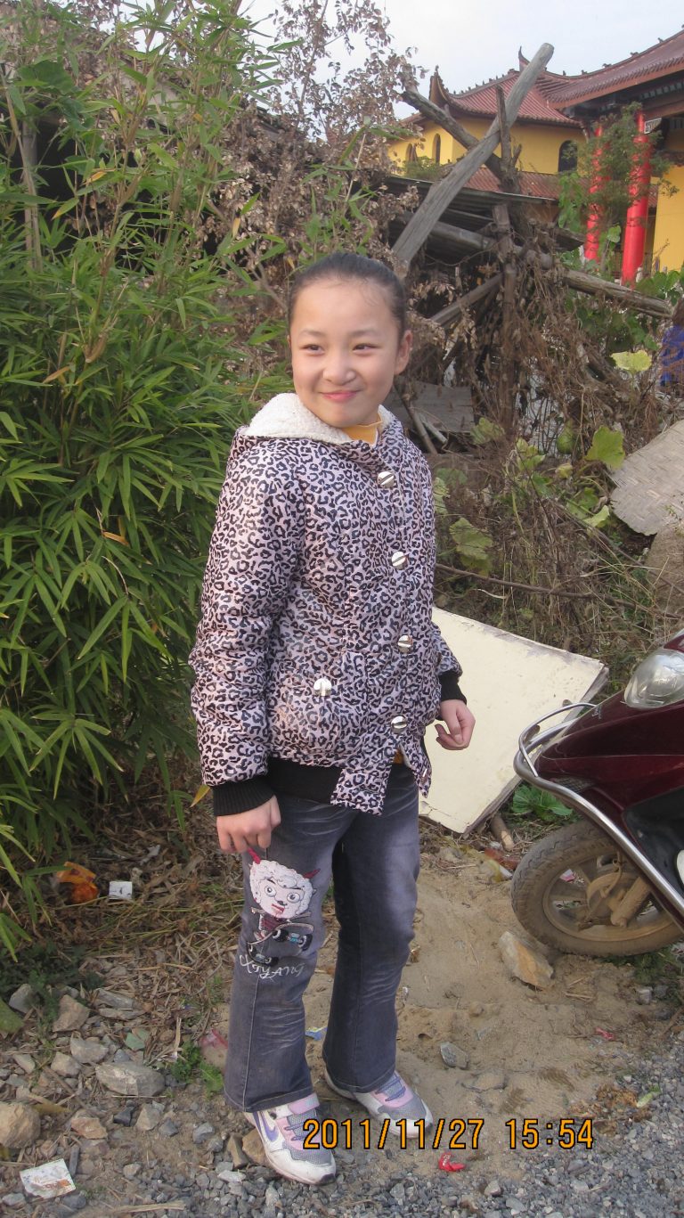 Pan Hui is a little girl with a cleft lip. – Women's Rights in China